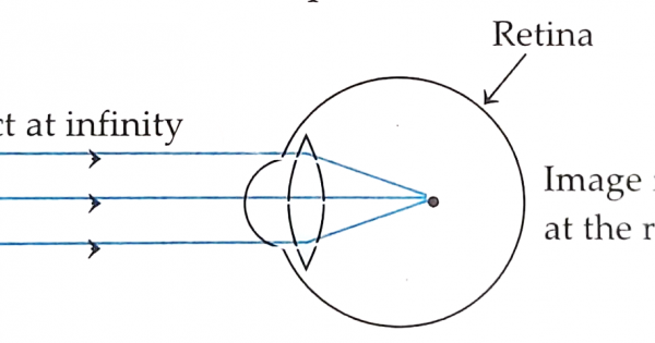Study the diagram given below and answer the questions: (i) Name the ...