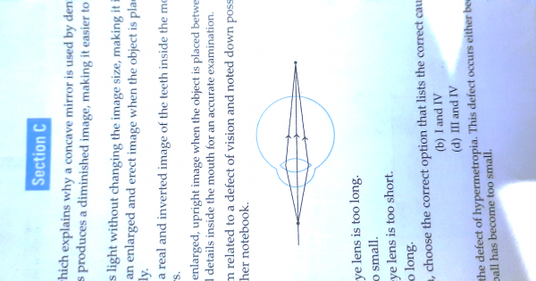 Renuka was studying a diagram related to a defect of vision and noted ...